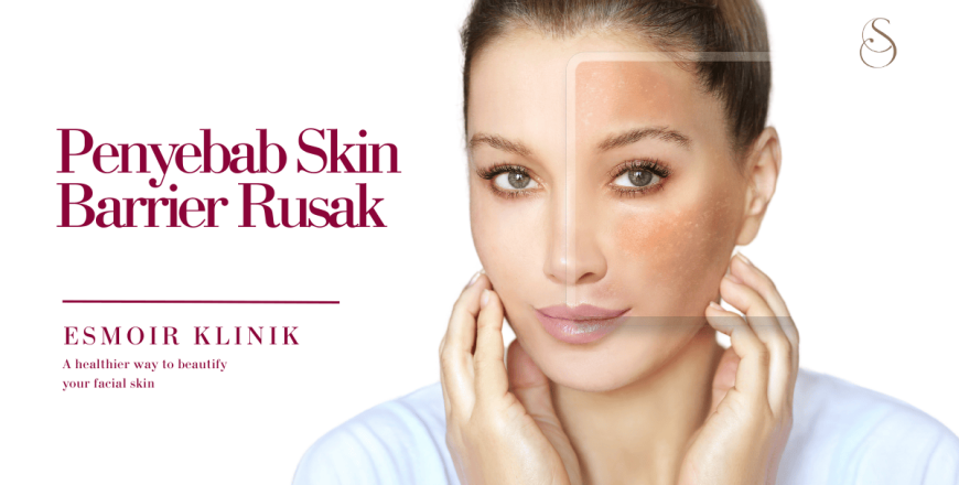 12 Penyebab Skin Barrier Rusak - No. 3 Bikin Kulit Nangis Kejer! - Esmoir