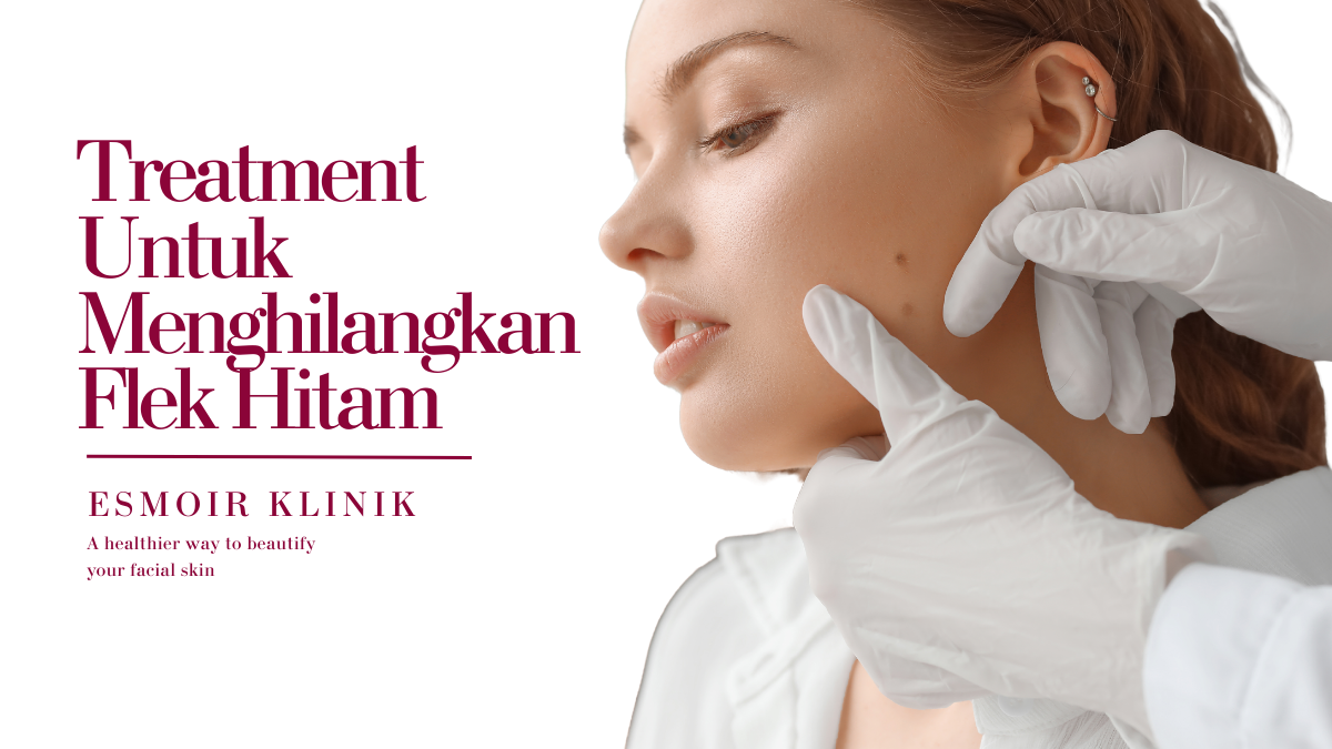5 Treatment Untuk Menghilangkan Flek Hitam! Nih Kata Dokter! - Esmoir