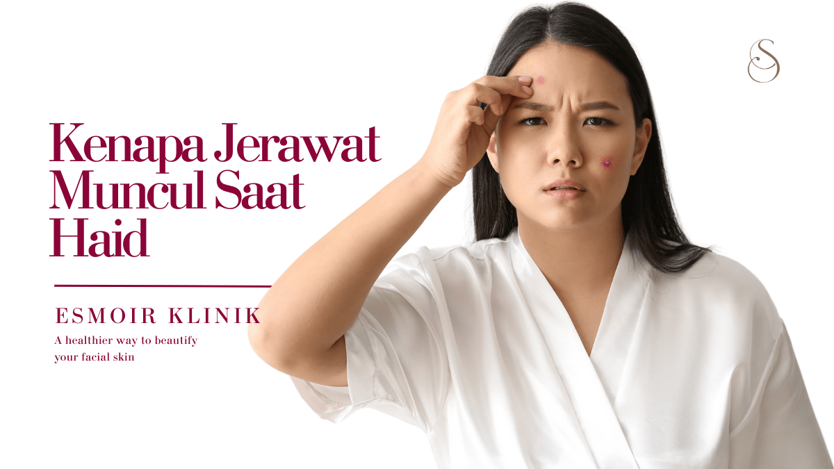 Kenapa Jerawat Muncul Saat Haid? Ini Penyebab dan Solusinya - Esmoir