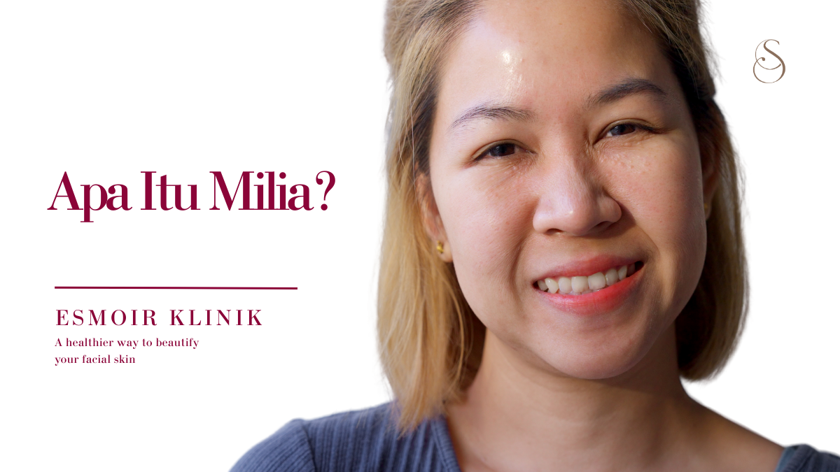 Apa Itu Milia? Ini Pengertian dan Bedanya dengan Jerawat - Esmoir