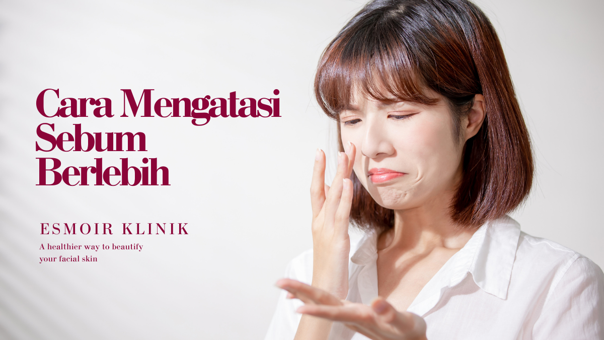 Stop Minyak di Muka! Cara Mengatasi Sebum Berlebih - Esmoir